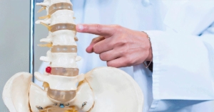 Abaulamento: Você Sabe o que é? – Dr. Alexandre Moulin